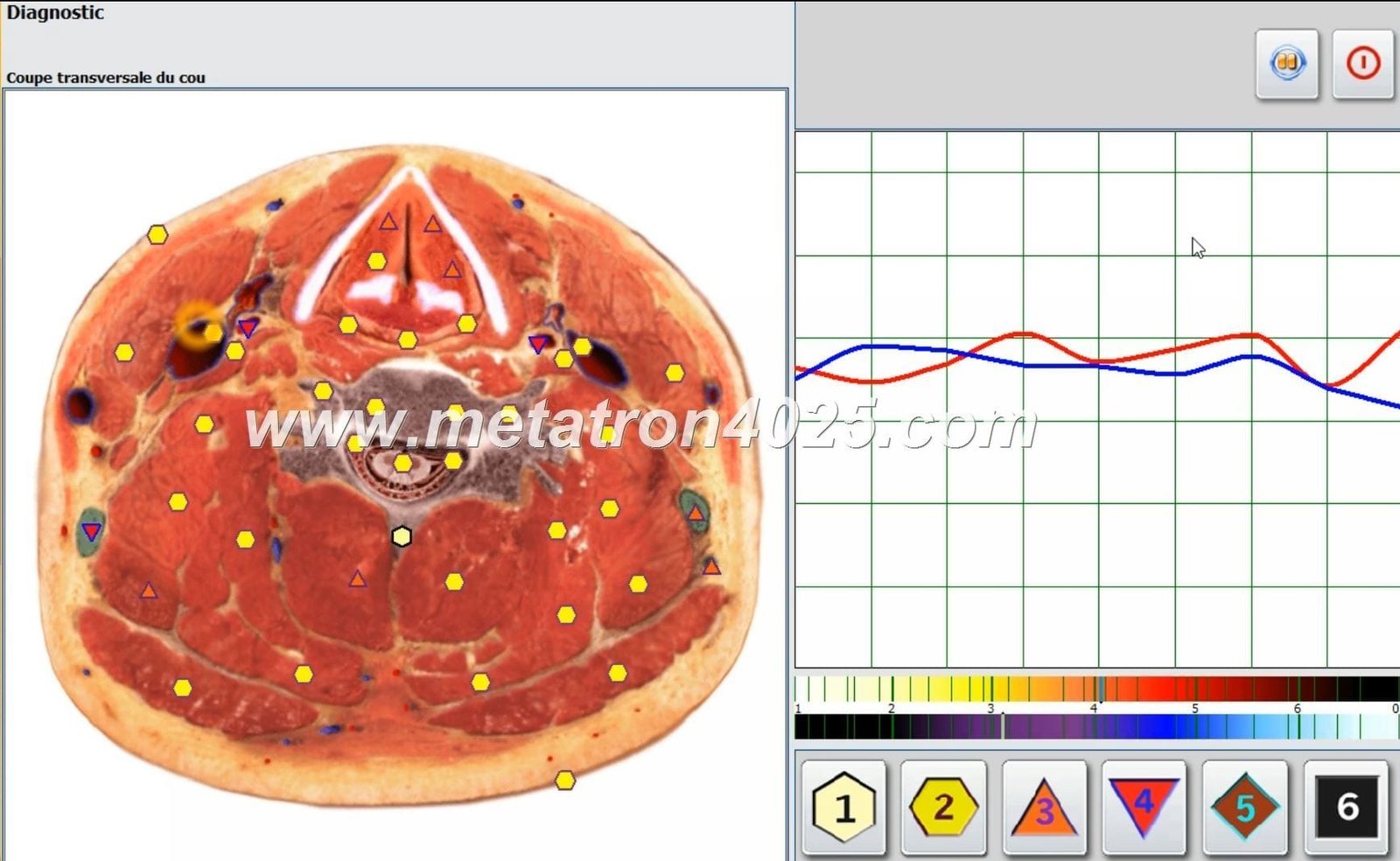 Unveiling The Potential Of Metatron NLS In Melbourne - Metatron Hunter ...
